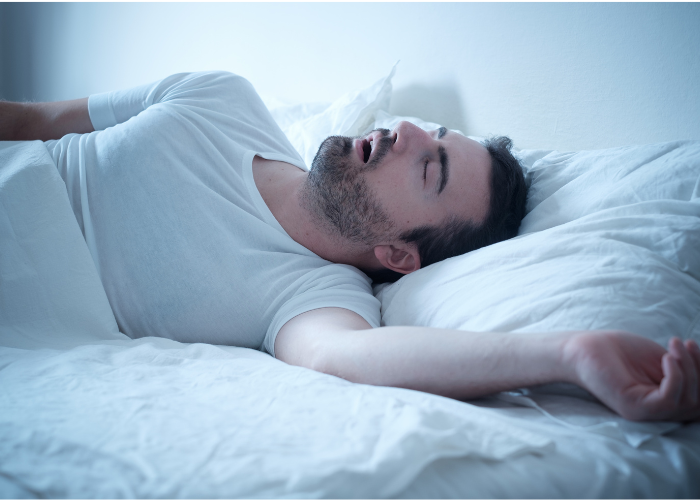 Causes of Sleep Apnea and Solutions | SleepQuest
